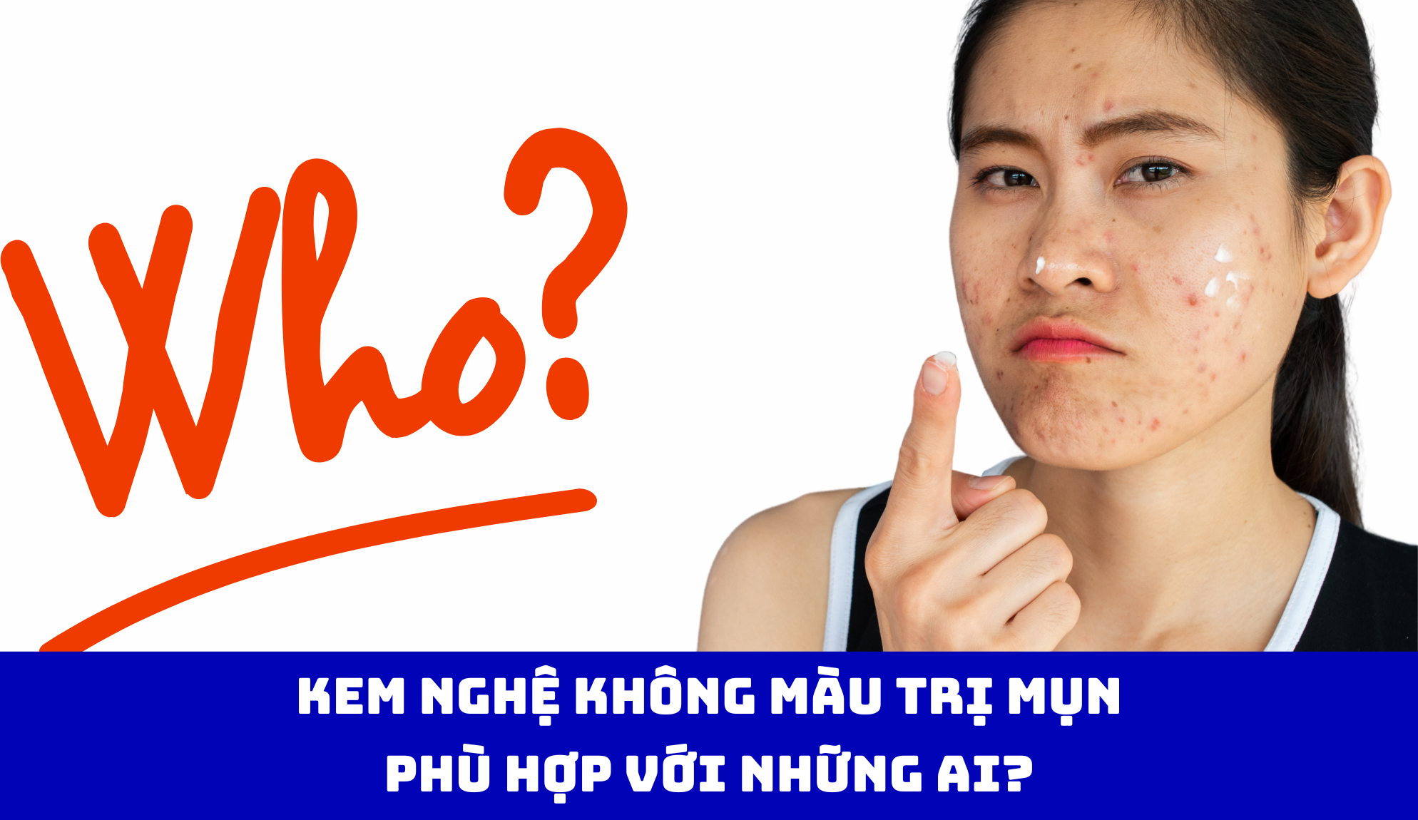 Kem Nghệ Không Màu Trị Mụn: Phù Hợp Với Những Ai?